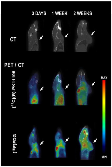 Potential of [11C](R)-PK11195 PET Imaging for Evaluating Tumor ...