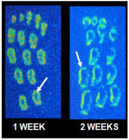 Potential of [11C](R)-PK11195 PET Imaging for Evaluating Tumor ...