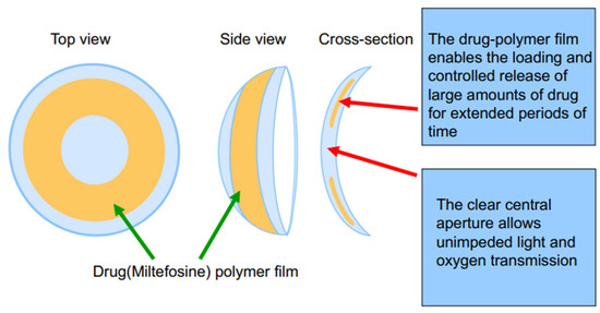 Topical Sustained Delivery of Miltefosine Via Drug-Eluting Contact ...