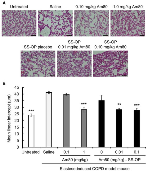 Pharmaceutics | Free Full-Text | Am80-Encapsulated Lipid Nanoparticles ...
