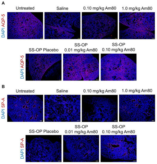 Pharmaceutics | Free Full-Text | Am80-Encapsulated Lipid Nanoparticles ...