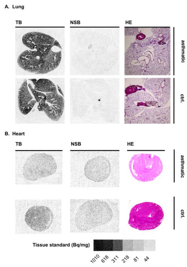 Imaging of Gαq Proteins in Mouse and Human Organs and Tissues