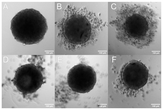 Novel Liposomal Formulation of Baicalein for the Treatment of ...