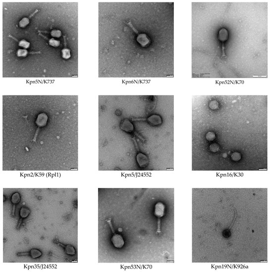 Characteristics of Environmental Klebsiella pneumoniae and Klebsiella ...