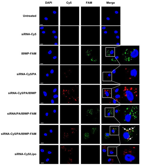 Intraocular siRNA Delivery Mediated by Penetratin Derivative to Silence ...