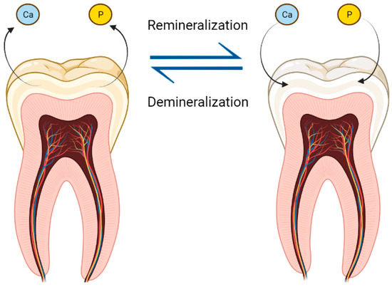 New Technological Approaches for Dental Caries Treatment: From Liquid ...