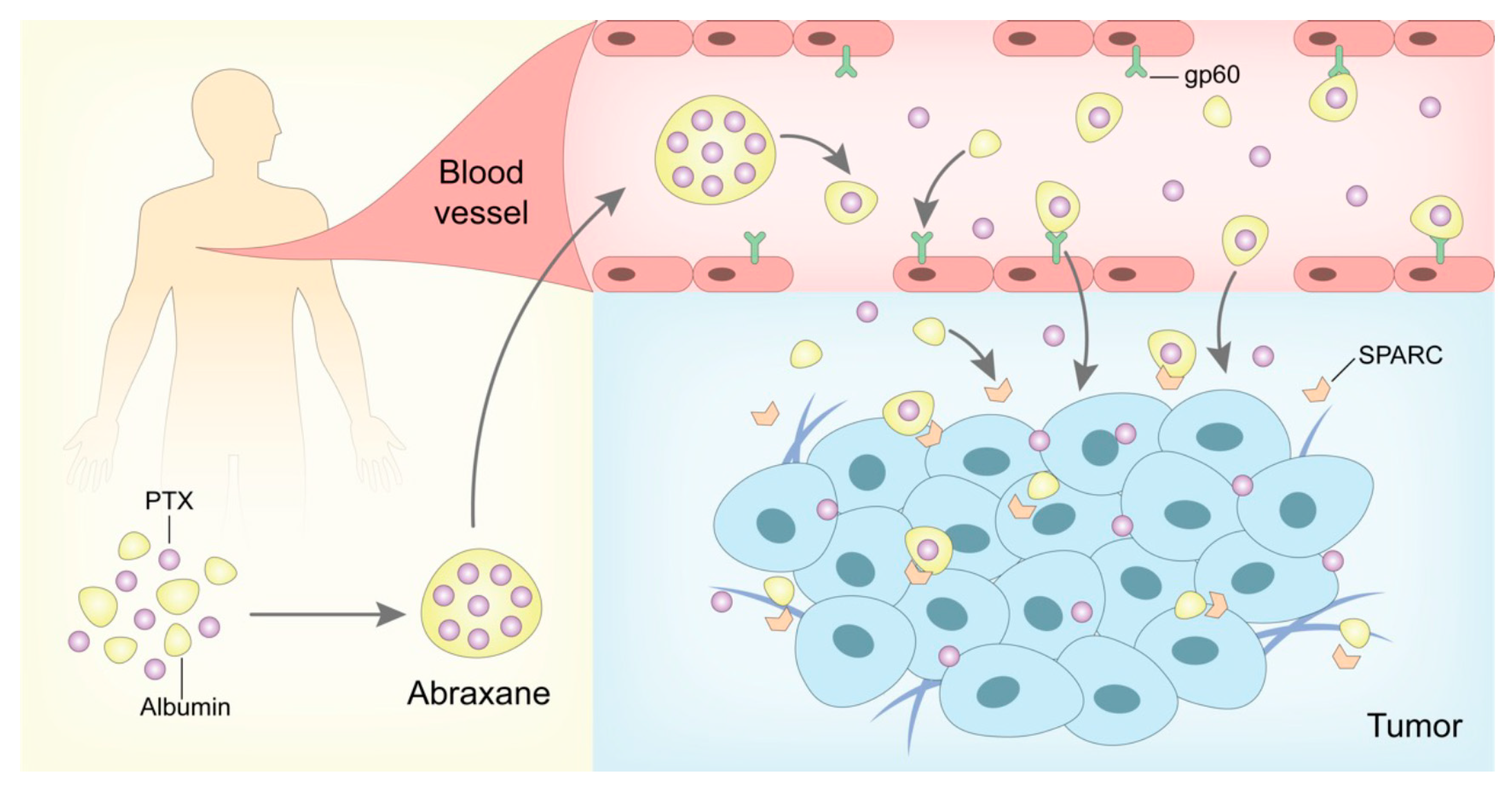 Pharmaceutics | Free Full-Text | Approved Nanomedicine against Diseases