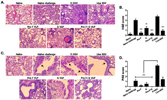 Virus-like Particle Vaccine Expressing the Respiratory Syncytial Virus ...