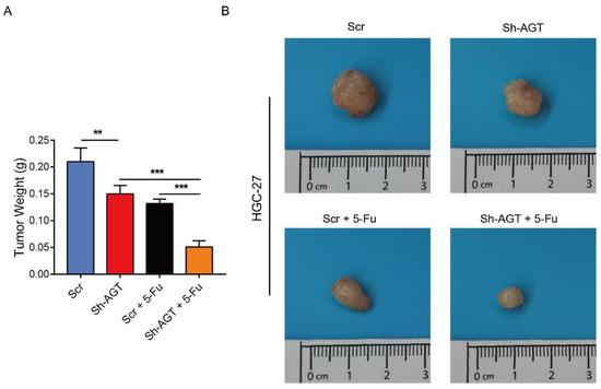System Analysis Based on Lipid-Metabolism-Related Genes Identifies AGT ...
