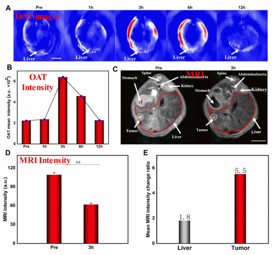 A Review of Advanced Multifunctional Magnetic Nanostructures for Cancer ...