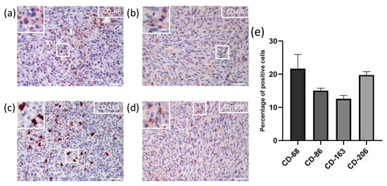 Targeting Glioblastoma-Associated Macrophages for Photodynamic Therapy Using AGuIX®-Design ...