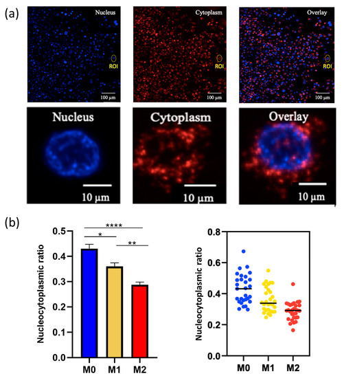 Targeting Glioblastoma-Associated Macrophages for Photodynamic Therapy Using AGuIX®-Design ...