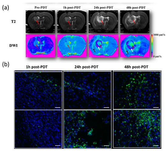 Targeting Glioblastoma-Associated Macrophages for Photodynamic Therapy Using AGuIX®-Design ...