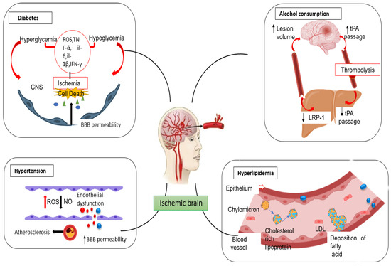 Stimuli-Responsive Nanotherapeutics for Treatment and Diagnosis of Stroke