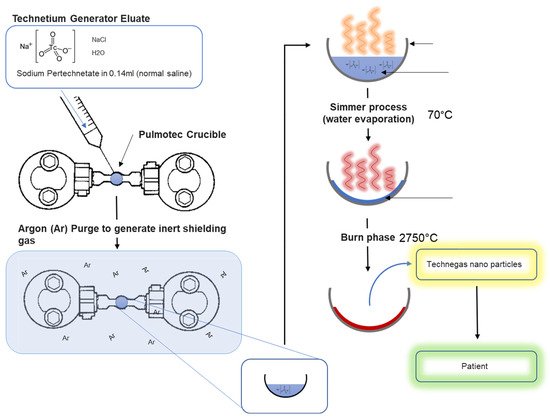 Technegas, A Universal Technique for Lung Imaging in Nuclear Medicine ...