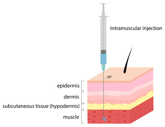 Lipid Nanoparticles as Promising Carriers for mRNA Vaccines for Viral ...