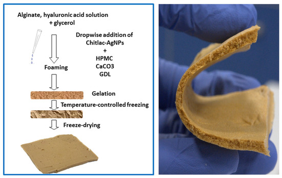 Alginate-Based Materials Loaded with Nanoparticles in Wound Healing
