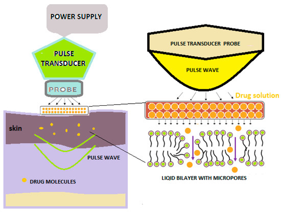 Strategies for Improving Transdermal Administration: New Approaches to ...