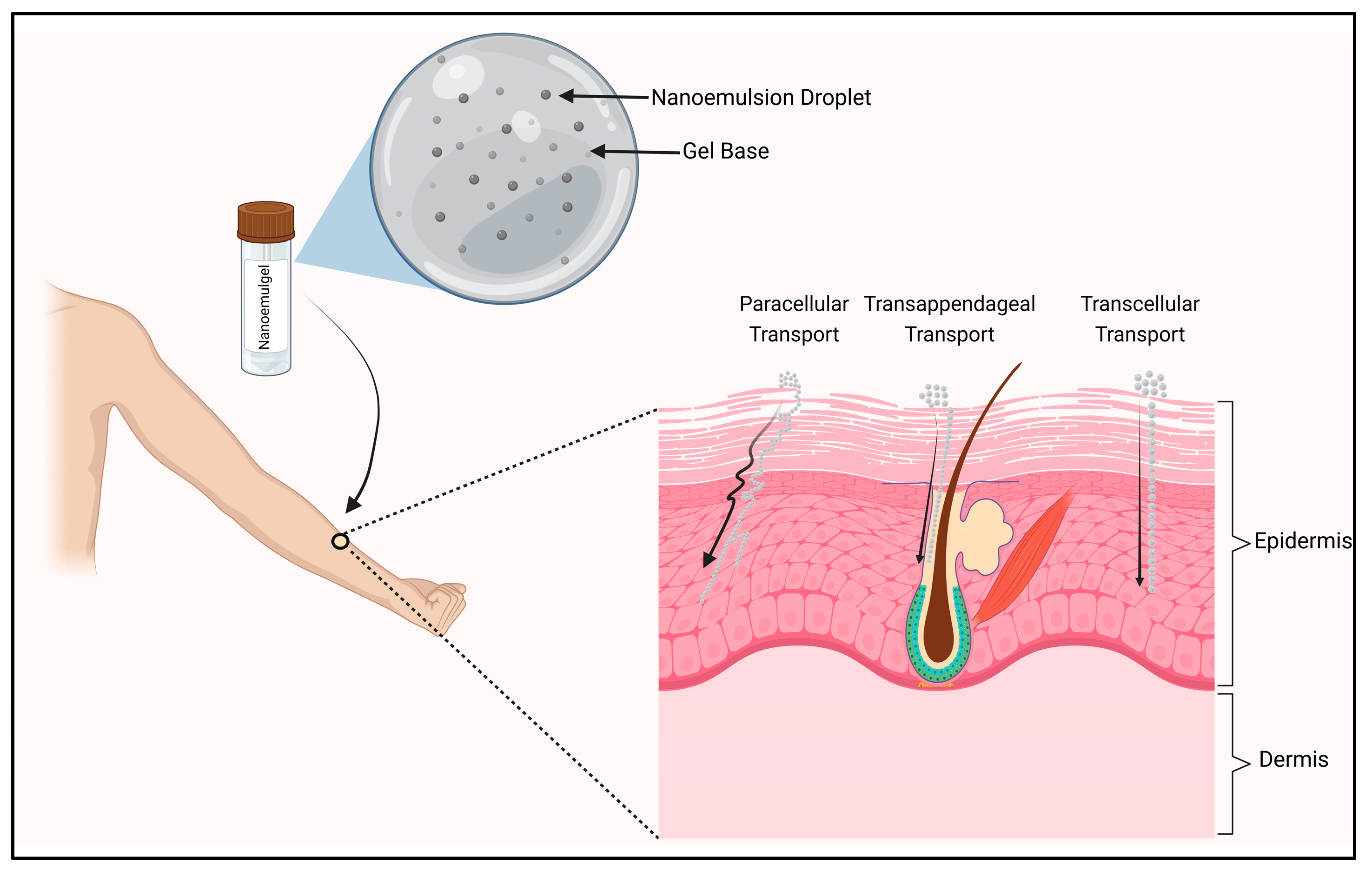An Overview of Nanoemulgels for Bioavailability Enhancement in Inflammatory Conditions via ...