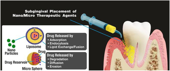 Local Delivery and Controlled Release Drugs Systems: A New Approach for ...
