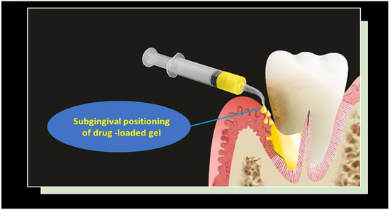 Local Delivery and Controlled Release Drugs Systems: A New Approach for ...