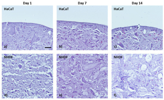 Marine Collagen-Based Bioink for 3D Bioprinting of a Bilayered Skin Model