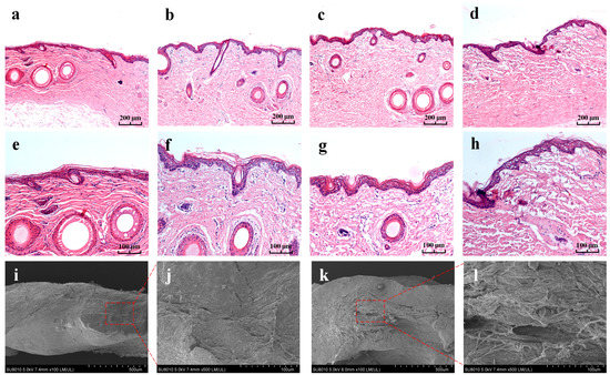 Topical Delivery of Ketorolac Tromethamine via Cataplasm for ...