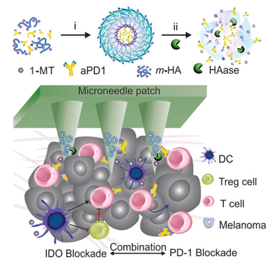 Responsive Microneedles as a New Platform for Precision Immunotherapy