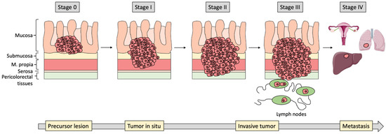 Antibody-Loaded Nanoplatforms for Colorectal Cancer Diagnosis and ...