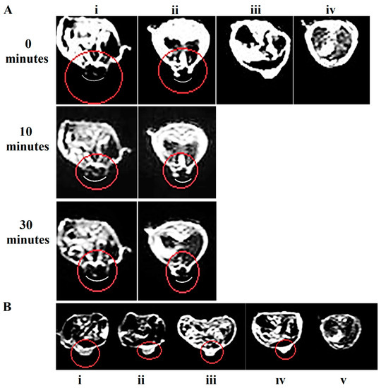 High Biocompatibility, MRI Enhancement, and Dual Chemo- and Thermal ...