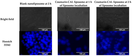Cinchonain Ia Shows Promising Antitumor Effects in Combination with L ...
