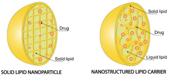 Solid Lipid Nanoparticles vs. Nanostructured Lipid Carriers: A ...