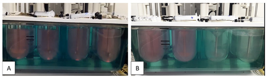 Development of a Discriminative Dissolution Method, Using In-Silico ...