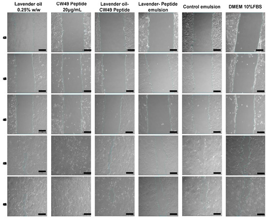 Enhancing Wound Healing: A Novel Topical Emulsion Combining CW49 ...