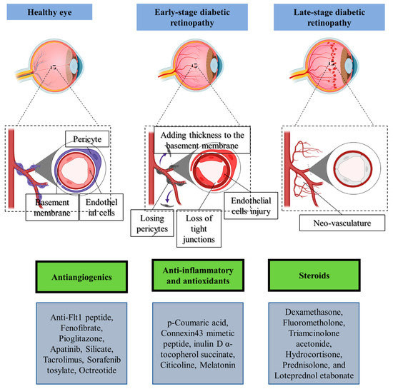 Recent Advances of Ocular Drug Delivery Systems: Prominence of Ocular ...