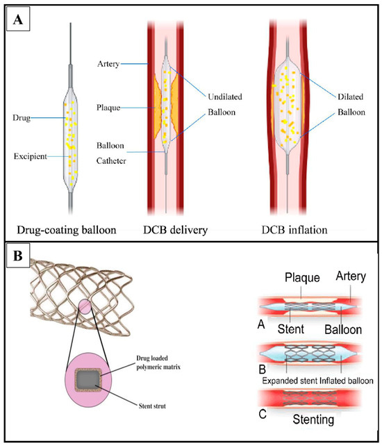 Treatment of Peripheral Artery Disease Using Injectable Biomaterials ...