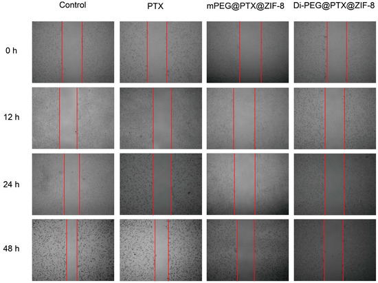Development of Novel Paclitaxel-Loaded ZIF-8 Metal-Organic Framework Nanoparticles Modified with ...