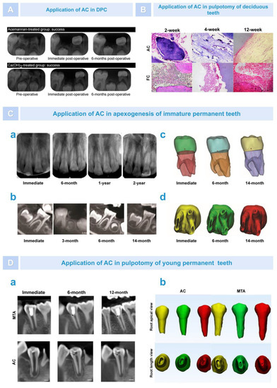 A New Biomaterial Derived from Aloe vera—Acemannan from Basic Studies ...