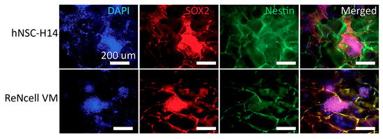 Chitosan Scaffolds as Microcarriers for Dynamic Culture of Human Neural ...