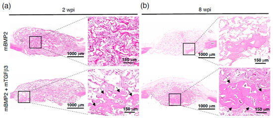 Administration of mRNA-Nanomedicine-Augmented Calvarial Defect Healing ...