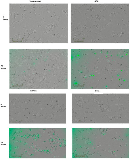 A Novel Dual-Payload ADC for the Treatment of HER2+ Breast and Colon Cancer
