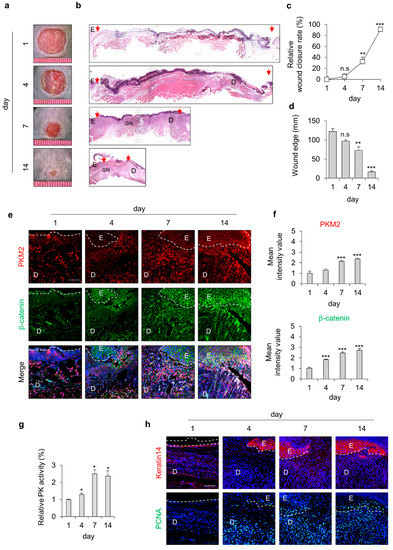 Pyruvate Kinase M2 Accelerates Cutaneous Wound Healing via Glycolysis ...