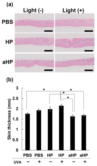 Locally Administered Photodynamic Therapy for Cancer Using Nano ...