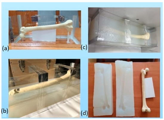 Rapid Prototyping Technologies: 3D Printing Applied in Medicine