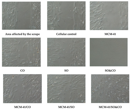 Mesoporous Composite Bioactive Compound Delivery System for Wound ...
