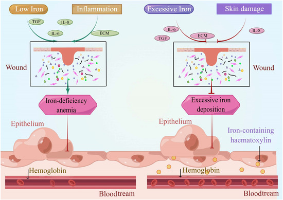 Iron Nanoparticles Open Up New Directions for Promoting Healing in ...