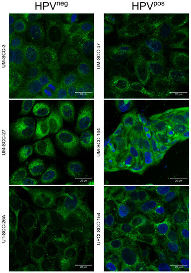 Lipid-Coated Polymeric Nanoparticles for the Photodynamic Therapy of ...