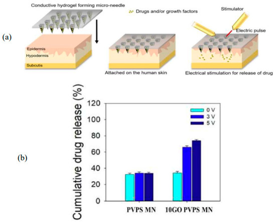 Hydrogel-Based Microneedle as a Drug Delivery System