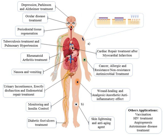 Hydrogel-Based Microneedle as a Drug Delivery System