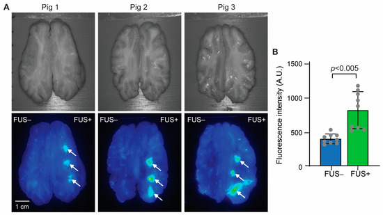 Focused Ultrasound-Mediated Delivery of Anti-Programmed Cell Death ...